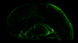 Your Lymphatic System: The #1 Most Neglected and 'Mysterious' Process ...
